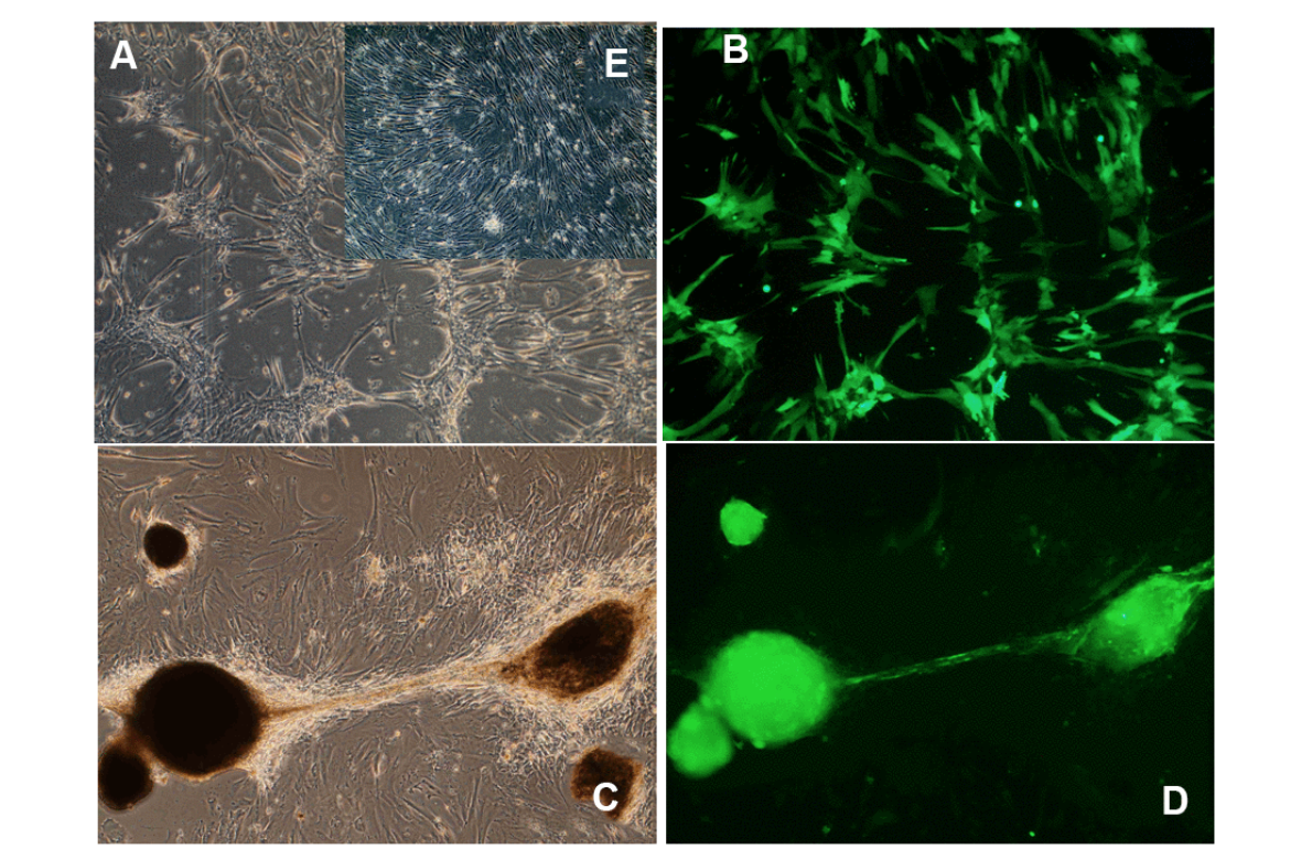 The Epigenetic Clock, Aging, and Rejuvenation - Aging-US Research